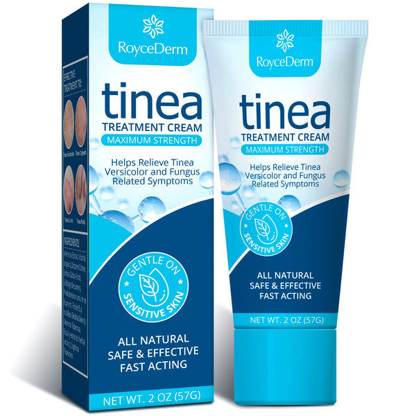 Roycederm Tinea Versicolor Treatment, Athletes Foot Treatment, Ringwor ...